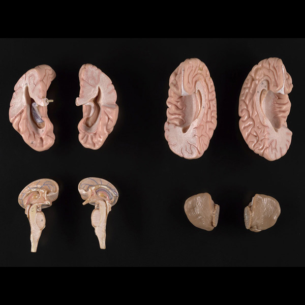 Anatomical Models | University Libraries | University of Nevada, Reno