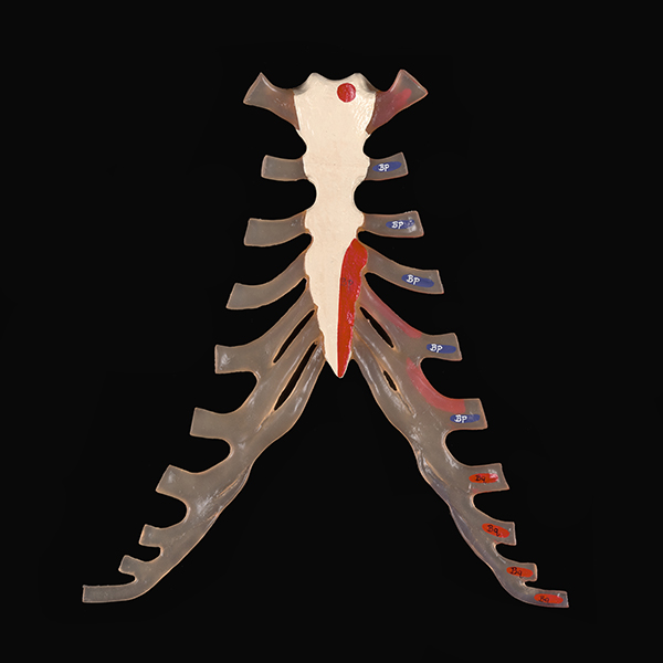 Savitt Anatomical Models | University Libraries | University of Nevada ...